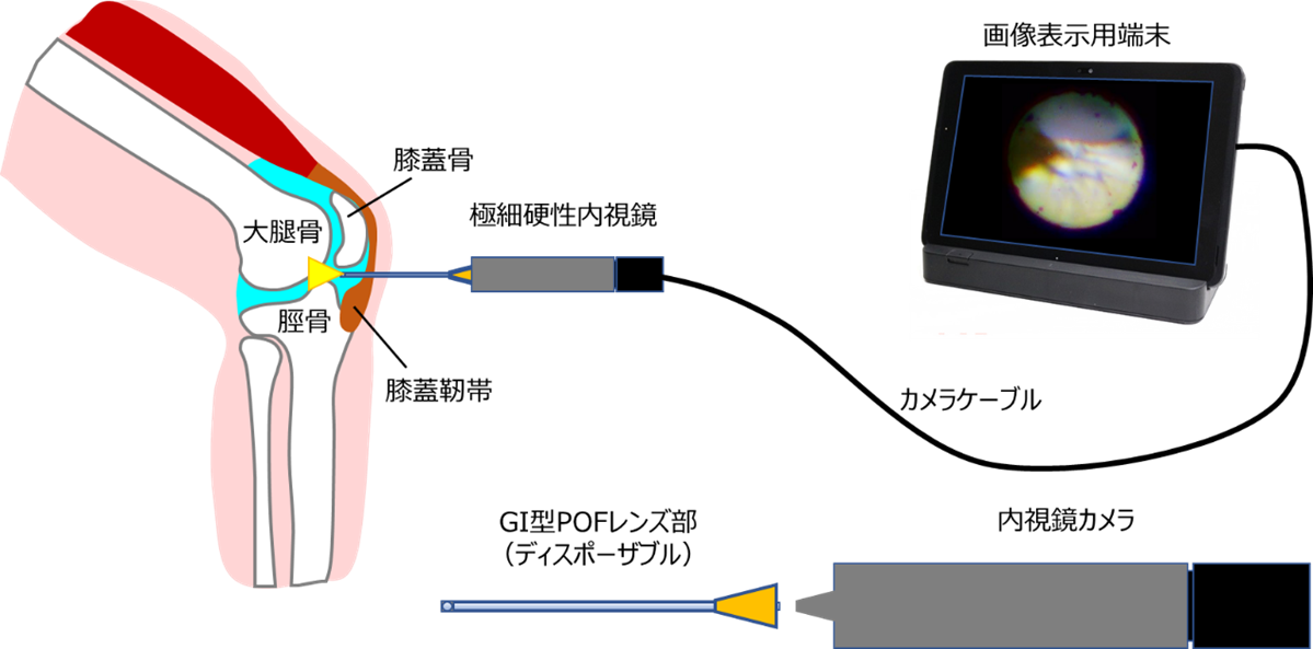 世界初（*1）、GI型POF（プラスチック光ファイバ）技術を応用し、注射針レベルの極細ディスポーザブル内視鏡の開発に成功｜エア・ウォーター ...
