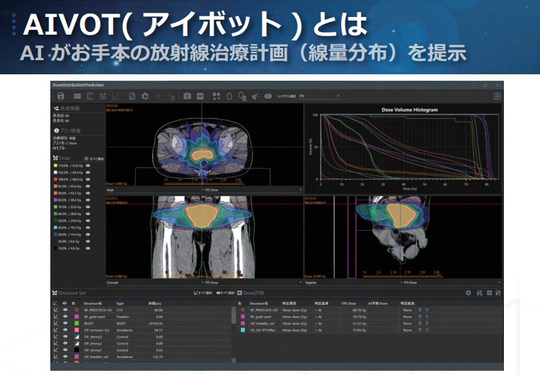 東北大学と共同開発したアイラト株式会社の放射線治療AI（AIVOT：アイボット）がTV東京 WBSに紹介されました。｜アイラト株式会社のプレスリリース
