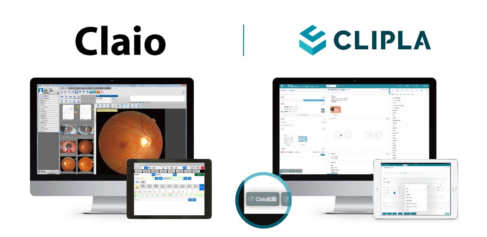 眼科向け電子カルテ『CLIPLA Eye』とファインデックスの画像ファイリングシステム『Claio（クライオ）』が連携を開始！｜株式会社エム ...