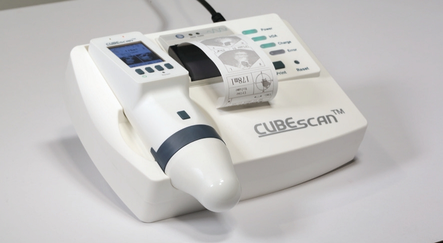 プローブとエコー画面を一体化した膀胱用超音波画像診断装置「キューブスキャンBioCon-900」を新発売｜株式会社ジェイ・シー・ティのプレスリリース