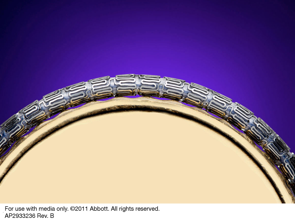 アボットの次世代薬剤溶出ステントXIENCE PRIME® （ザイエンスプライム）｜アボット バスキュラー ジャパン株式会社のプレスリリース