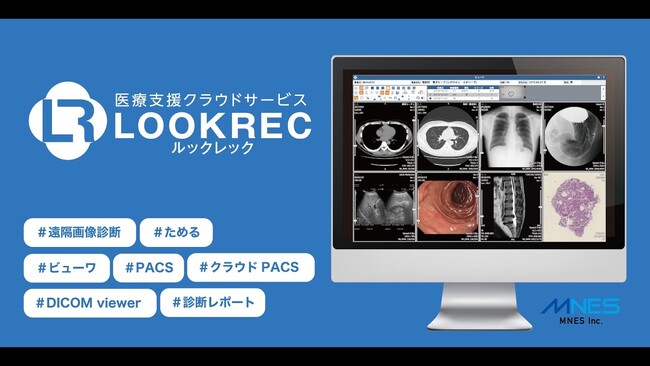 産婦人科向け電子カルテ『CLIPLA Luna』と株式会社エムネスの『LOOKREC』が連携を開始｜エムネスのプレスリリース