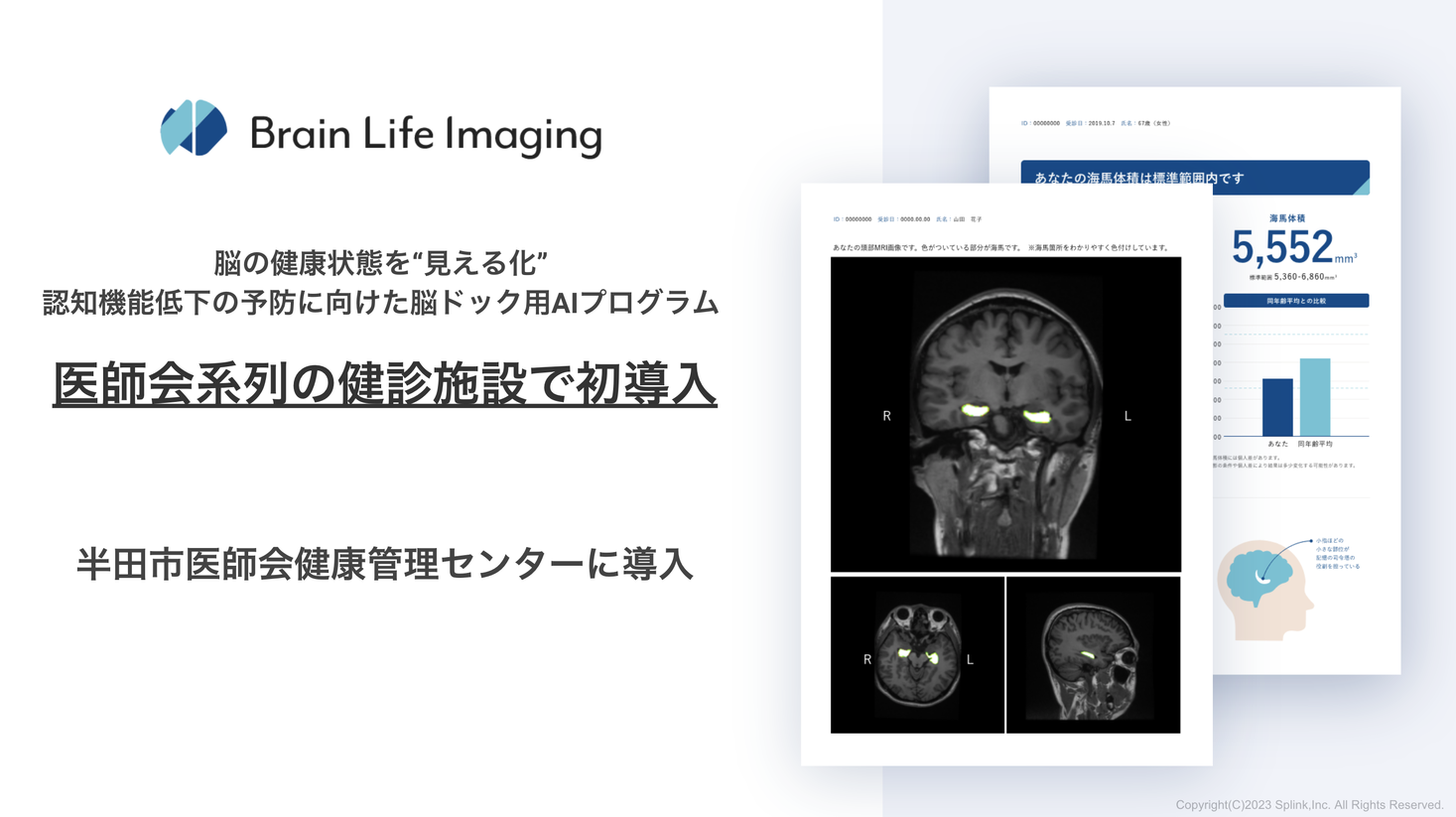 【医師会系列の健診施設で初導入】認知機能低下の予防に向けた脳ドック用AIプログラム「Brain Life Imaging® 」が半田市医師会健康管理センターで導入｜株式会社Splinkのプレスリリース